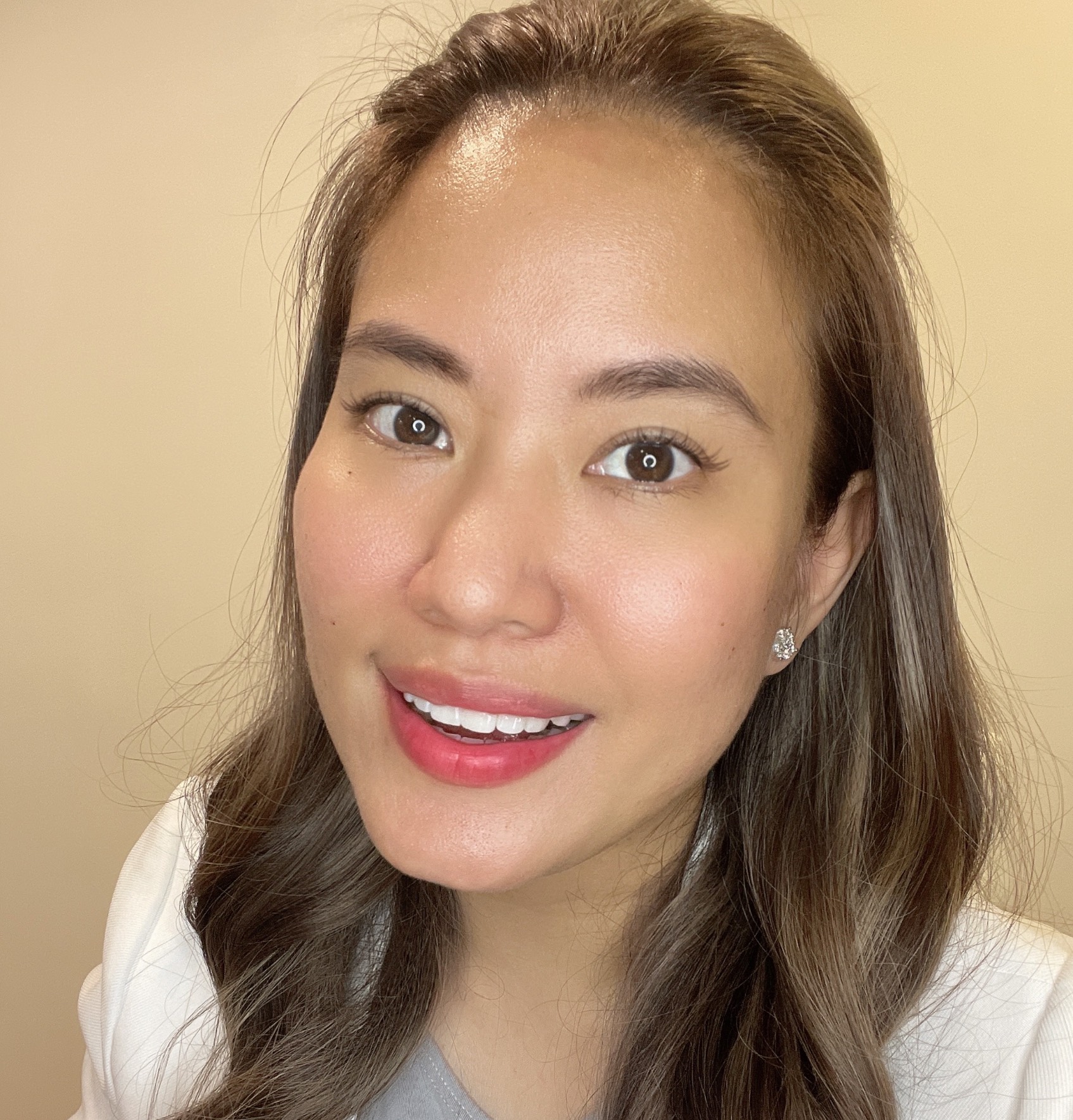 Dental Clinic in Ortigas | Dental Implants | Cosmetic Dentist